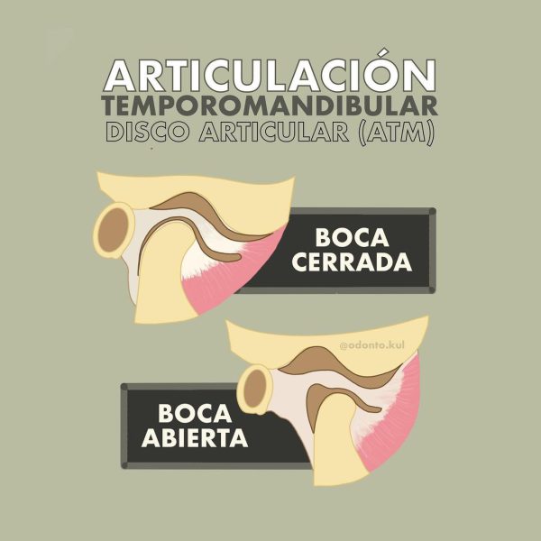 Articulación Temporomandibular Disco Articular (ATM) — Perú Dentistry
