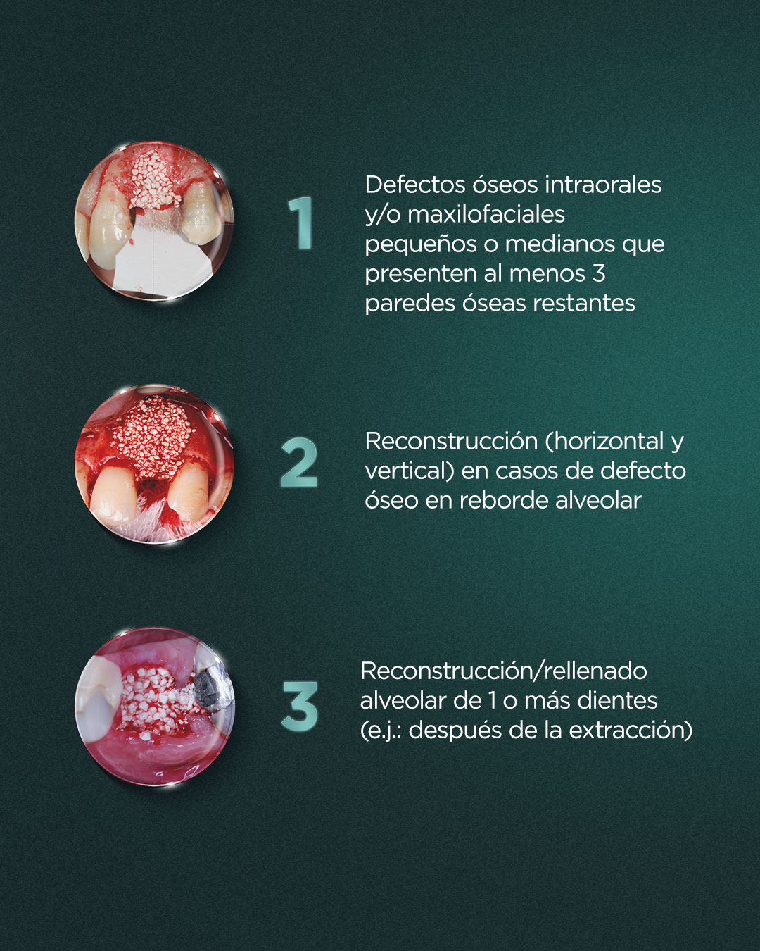 ¡Descubre 7 indicaciones para tu rutina clínica con Nanosynt, el ...