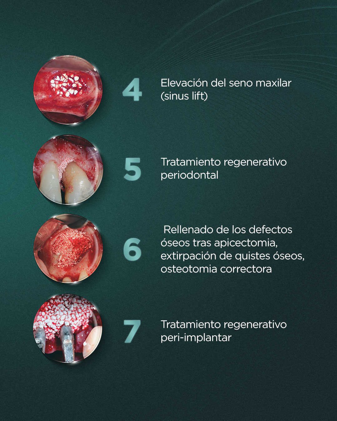 ¡Descubre 7 indicaciones para tu rutina clínica con Nanosynt, el ...